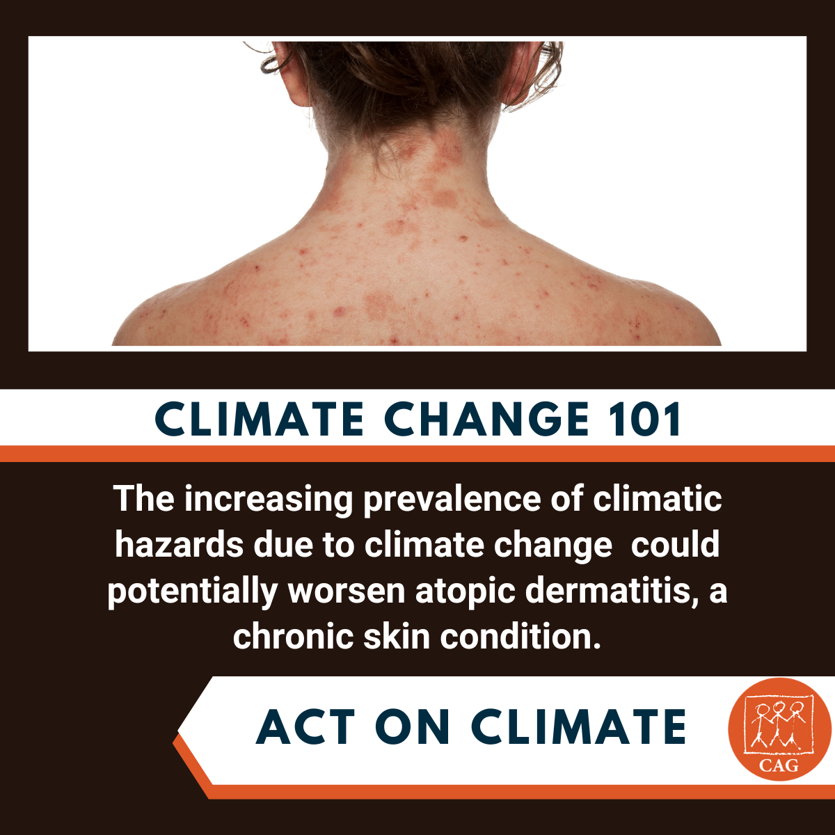 Climate Change - Higher pollen levels | CAG